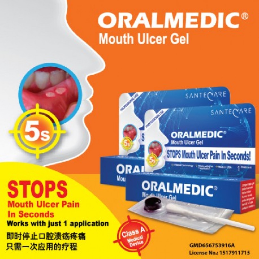 2 UNITS OF ORALMEDIC MOUTH ULCER GEL 0.3ML